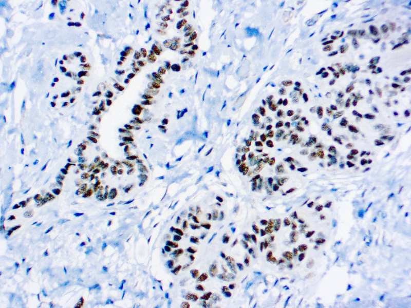 Wilms Tumor 1 Protein Wt1 Diagnostic Biosystems