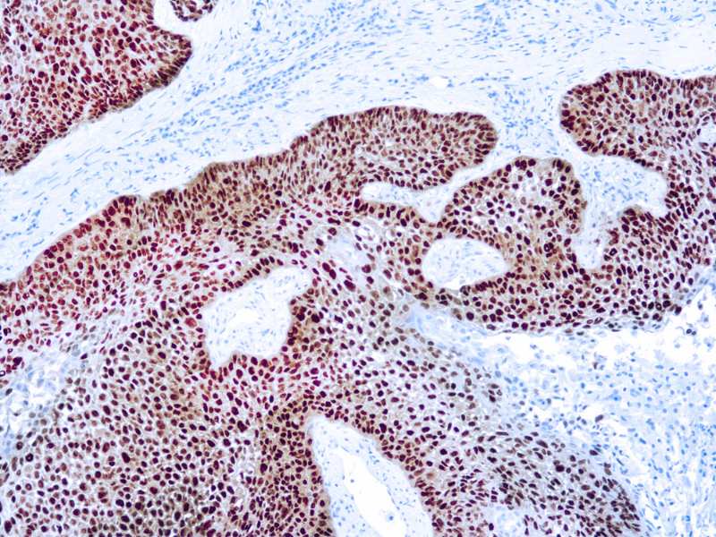 P63 Diagnostic BioSystems Immunohistochemistry Primary Antibodies P63 Diagnostic BioSystems Immunohistochemistry Primary Antibodies