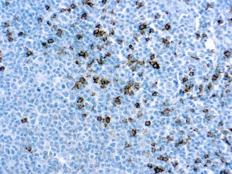 Mouse Anti-CD8 T-Cell Monoclonal Antibody (Clone 144B) Clinisciences