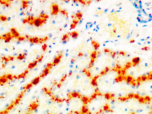 Copper Stain Kit – Diagnostic BioSystems (DBS)