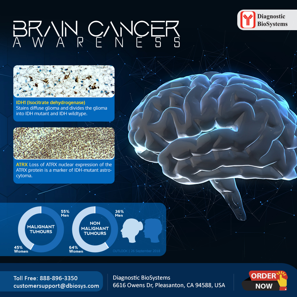 Brain Cancer Awareness - Diagnostic BioSystems -Advanced Tissue ...