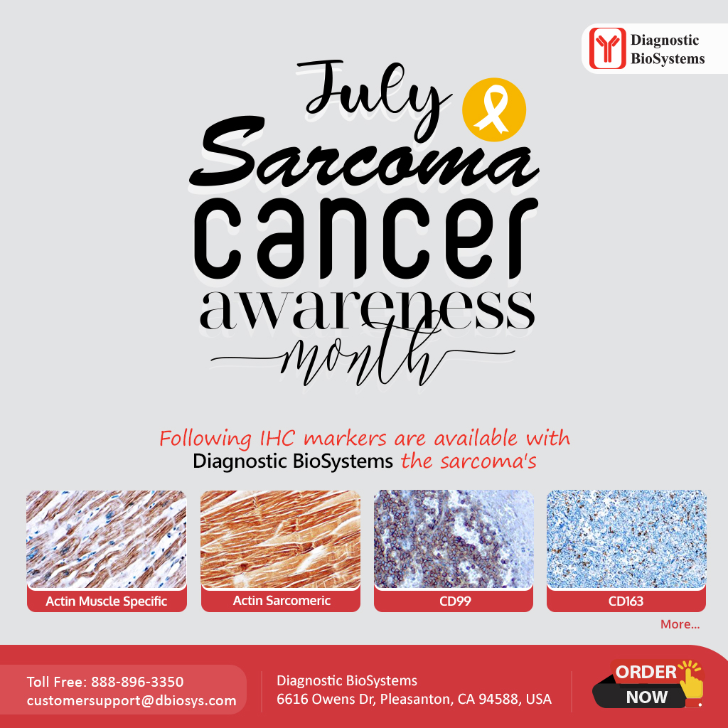 July Is Sarcoma Cancer Awareness Month - Diagnostic BioSystems ...