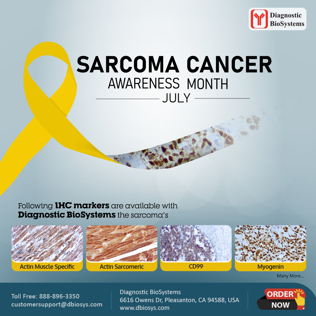 Sarcoma Cancer Awareness - Diagnostic BioSystems -Advanced Tissue ...